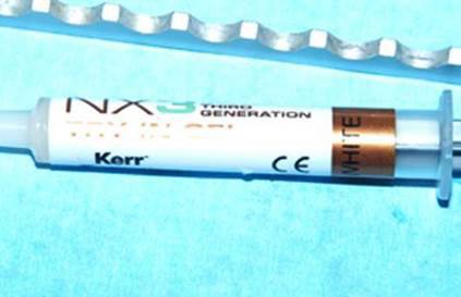 Casus Kerr: Esthetische indirecte restauratie met keramische facing ...