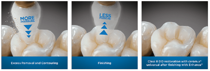 Enhance Finishing systeem - dentalinfo.nl