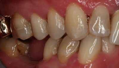 Dahlframes, orthodontie en een ‘restricted envelope of function ...