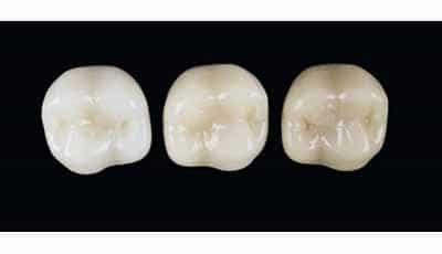 Venus Pearl/Diamond ONE. De juiste kleur, iedere keer weer! - dentalinfo.nl