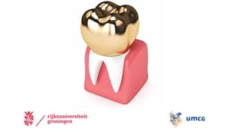 Onderzoek: Toepassing van de Hall-techniek door tandartsen in Noord ...