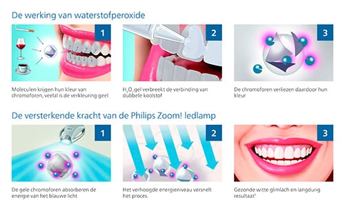 Het bleekseizoen is begonnen! Ontdek alles over de professionele ...